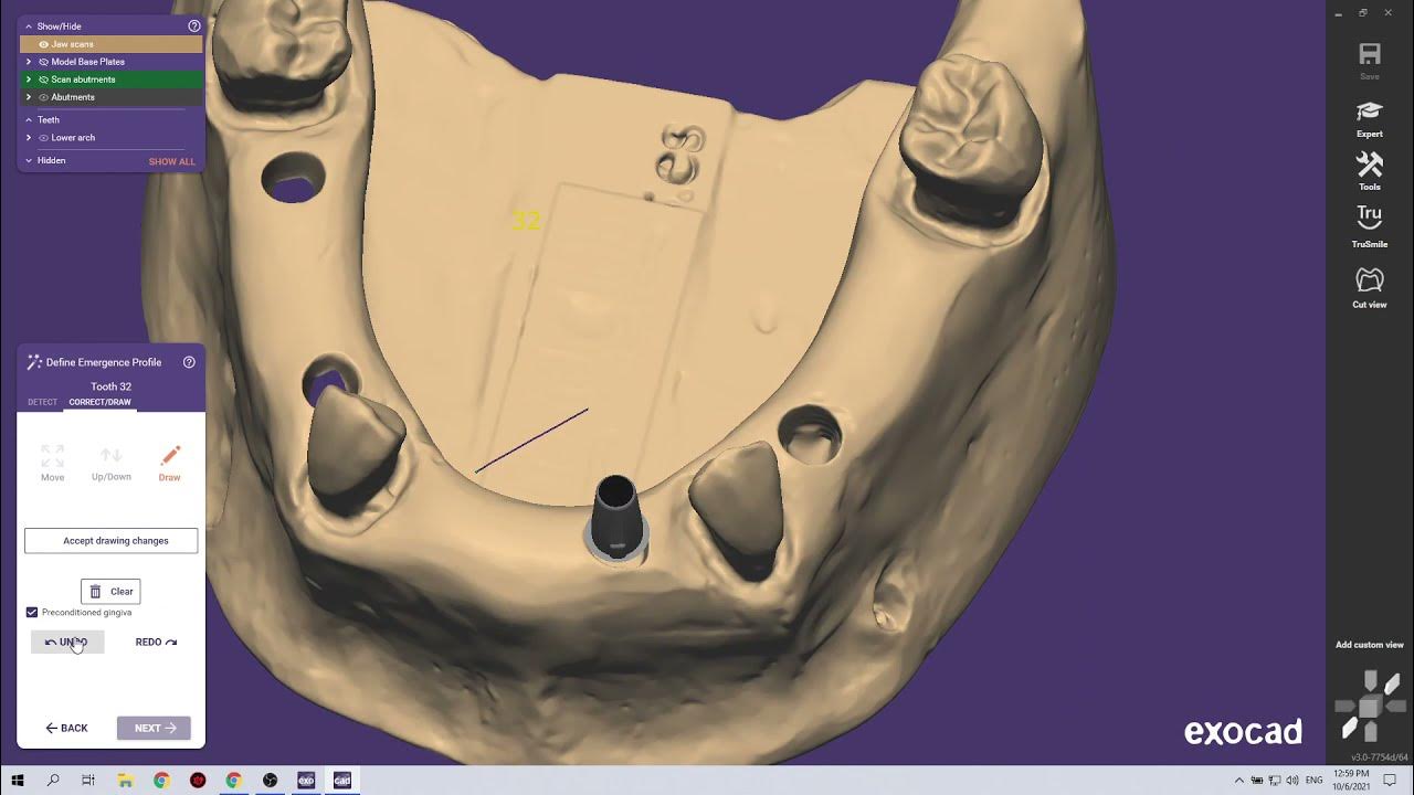 EXOCAD libraries installation - YouTube