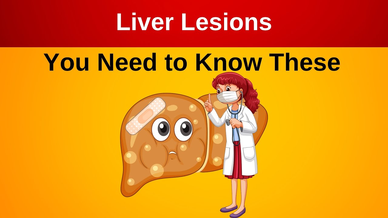 Benign and Malignant Liver Lesions: A Comprehensive Guide - YouTube