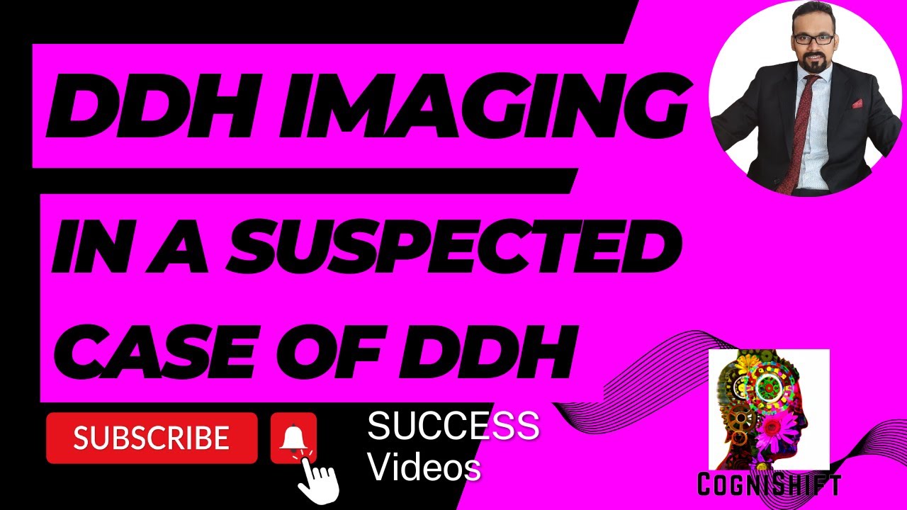 DDH developmental dysplasia of the hip Imaging Mnemonics and Mind Maps ...