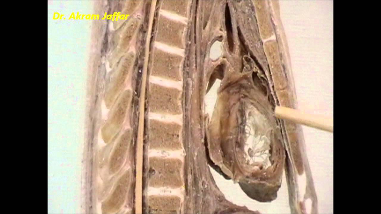 Sagittal sections of the thorax - YouTube