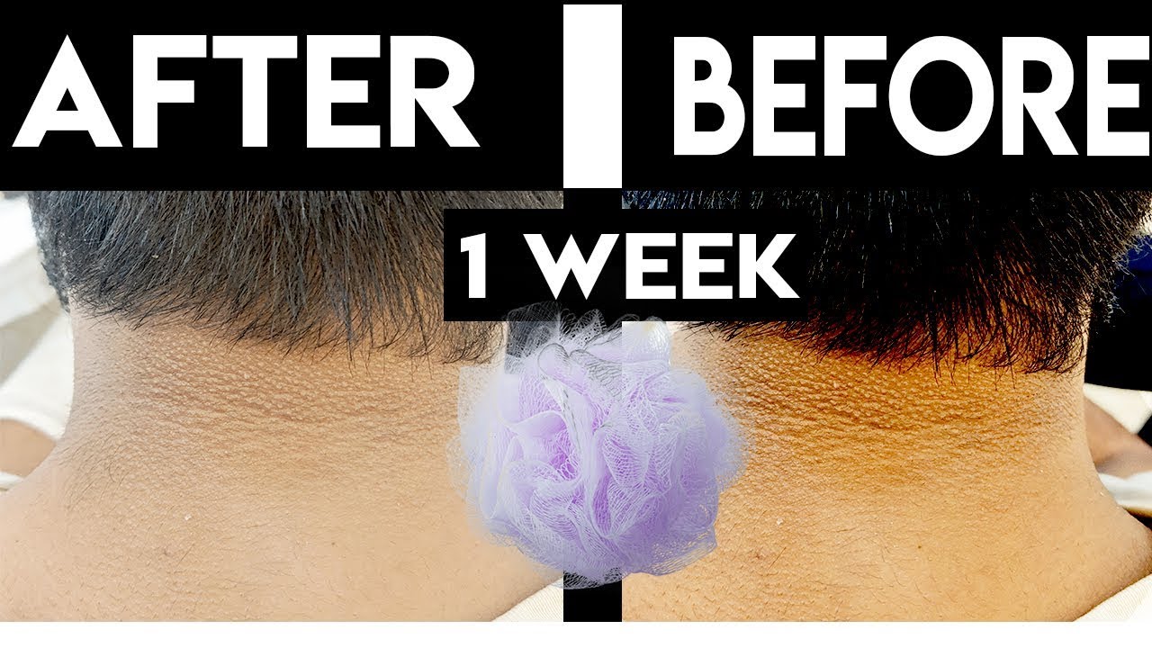 DARK TO BRIGHT NECK AT HOME | SIMPLE STEPS FOR NECK WHITENING - YouTube