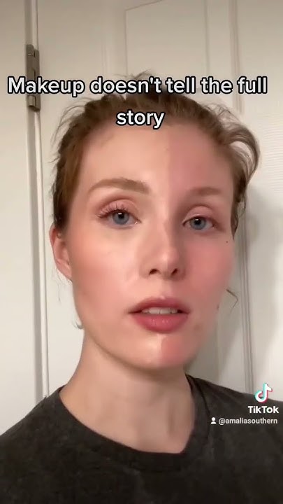 Don't compare yourself to models - YouTube