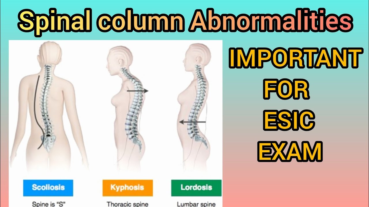 spinal column deformities - YouTube