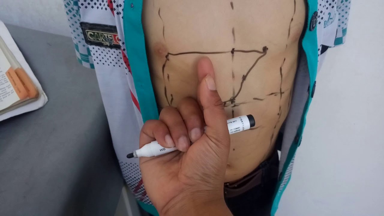 SURFACE MARKING of GALLBLADDER and BILE DUCT in easiest way - YouTube