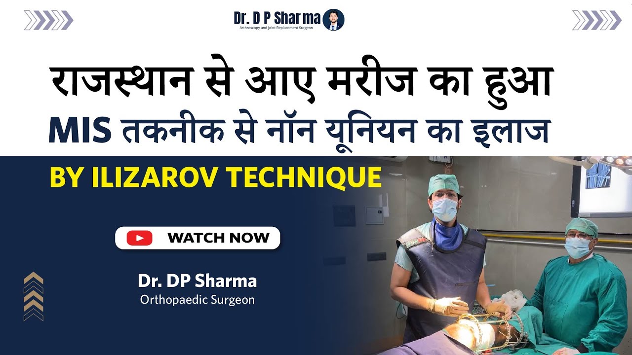 Non Union Treatment Using MIS Ilizarov Technique Of Rajasthan's Patient ...