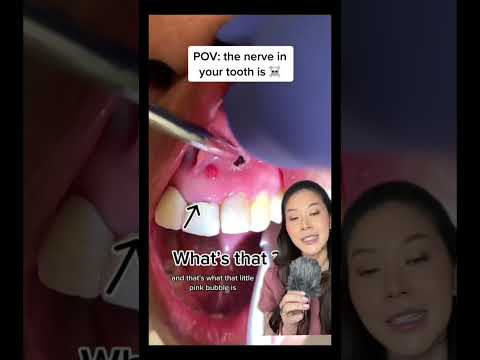 How Does Dentist Know If Tooth Is Dying
