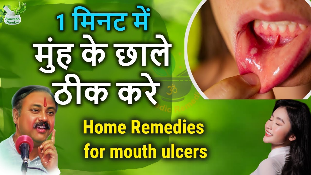 1 दिन में मुंह के छाले ठीक करे/ muh ke chhale ka ilaaj baba ramdev,Home ...