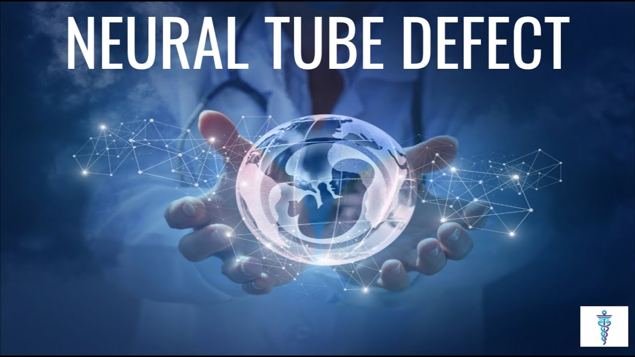 NEURAL TUBE DEFECT: ANENCEPHALY, SPINA BIFIDA, CRANIORACHISCHISIS ...