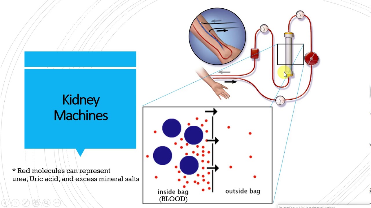 Igcse Biology 2i Excretion Humans EXCRETION IN HUMANS BIOLOGY IGCSE