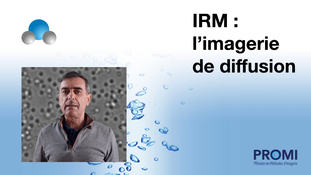IRM diffusion - YouTube