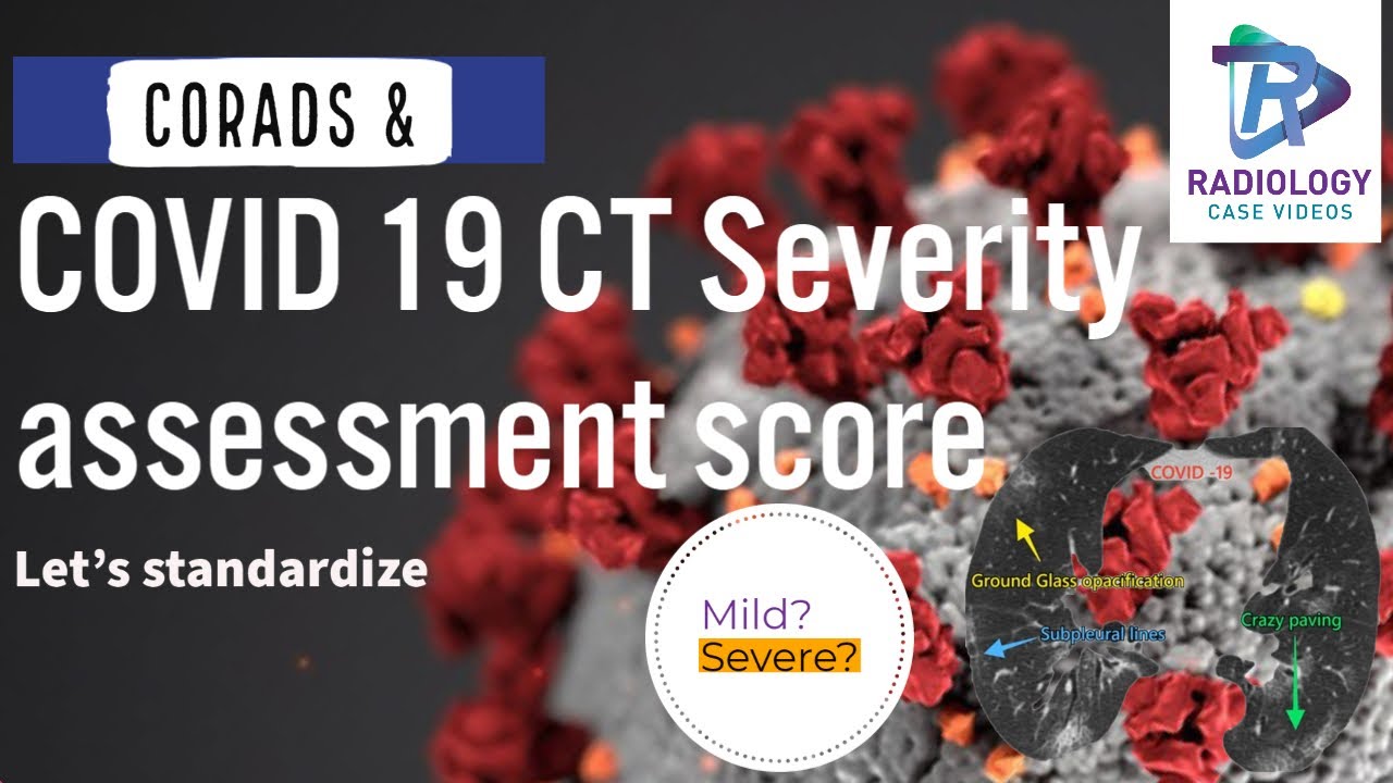 CORADS and CT Severity score what every Covid warrior should know ...