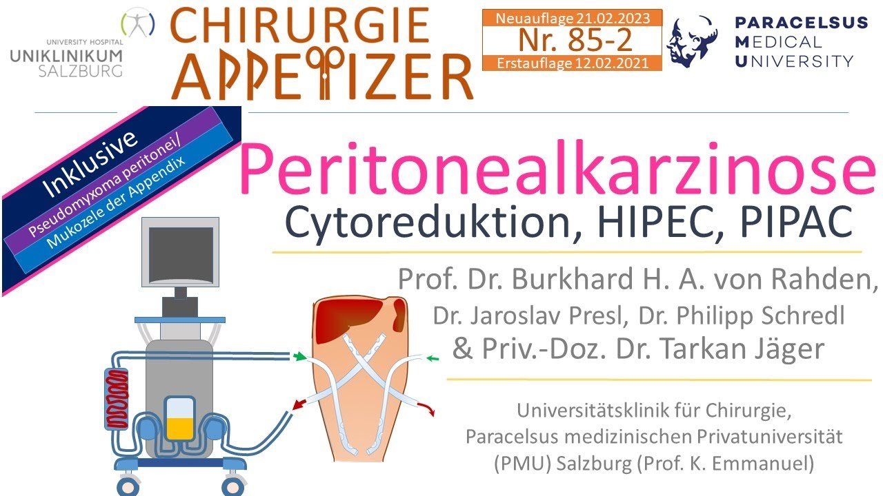 Peritonealkarzinose, HIPEC, PIPAC CHIRURGIE APPetizer Nr. 85-2 ...