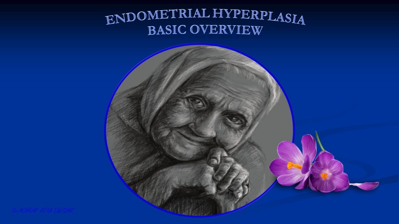 DR ASHRAF ATIA DWIDAR :ENDOMETRIAL HYPERPLASIA - YouTube
