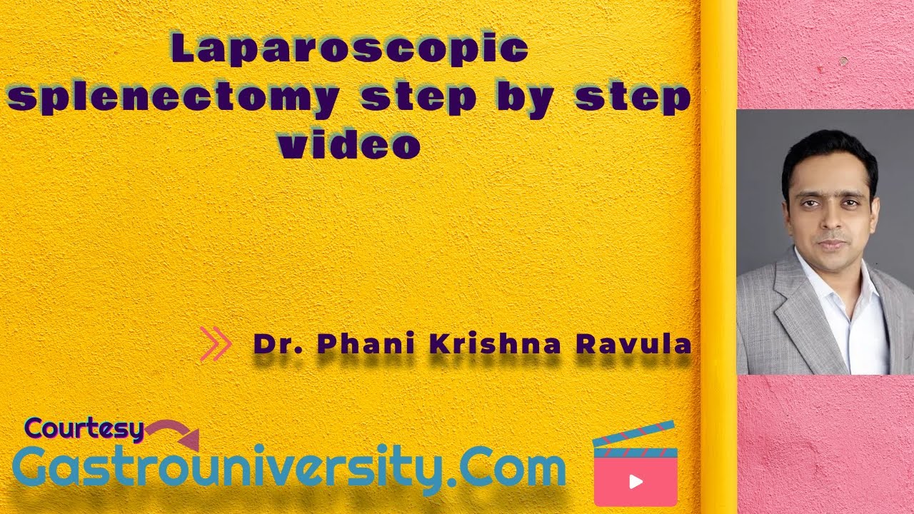 Spleen-Laparoscopic splenectomy step by step video - YouTube