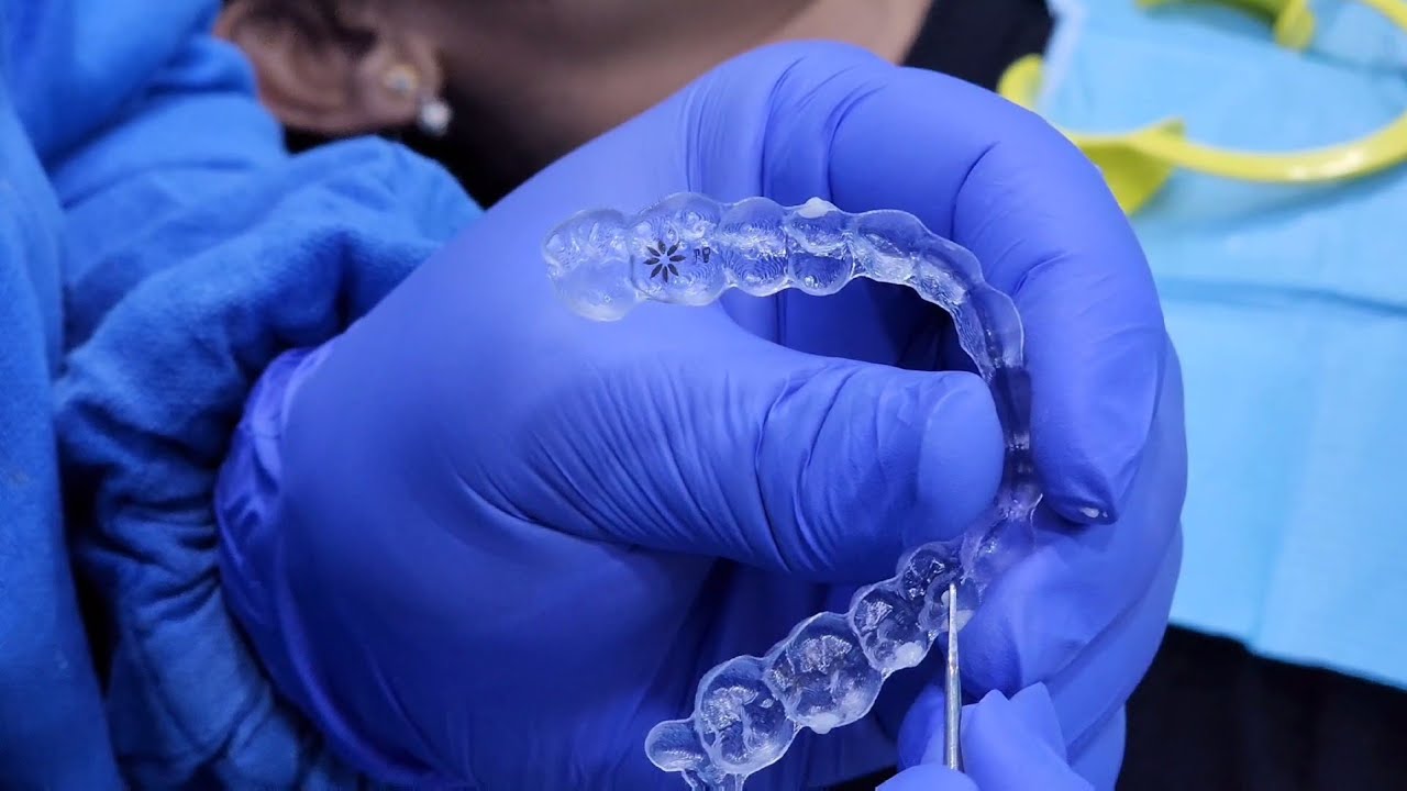 Clear Aligner | Invisalign- Bonding of attachments - YouTube