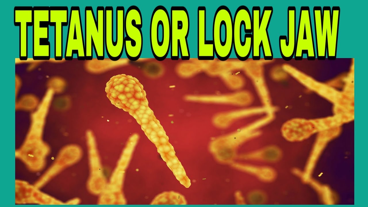 TETANUS OR TRISMUS OR LOCKJAW تشنج - YouTube