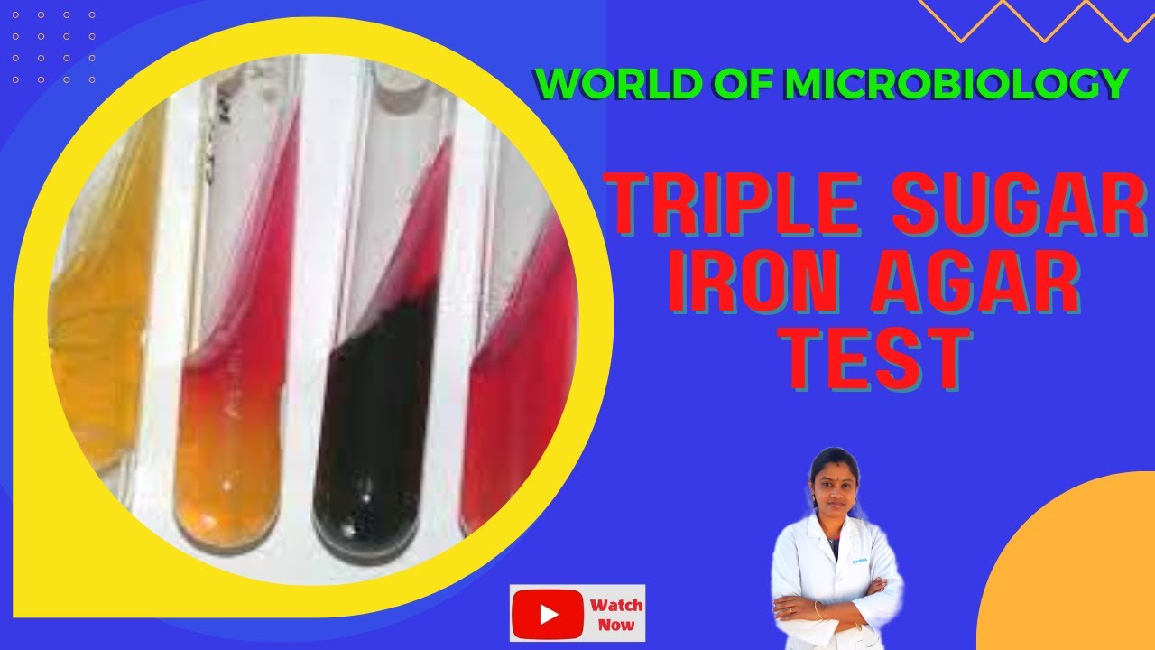 Triple Sugar Iron (TSI) Agar Test (Tamil) || Identification of Bacteria ...