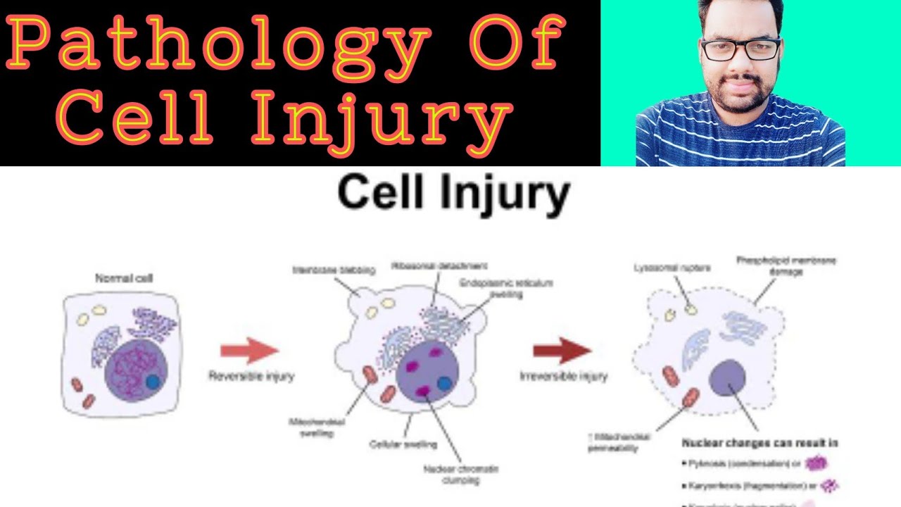 #Pathology # Cell Injury... Pathology Of Cell Injury Part 1 - YouTube