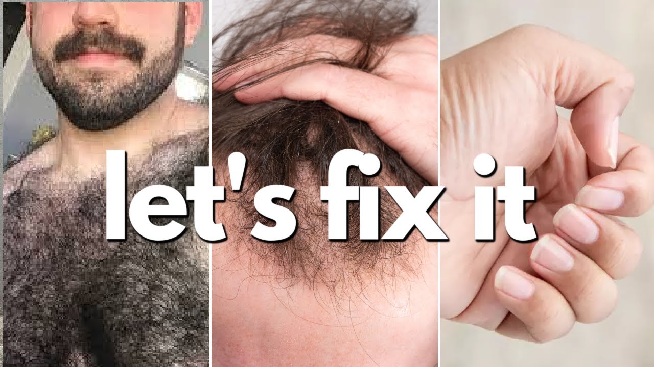 10 Most Unattractive Physical Traits On Men (How To Fix) - YouTube