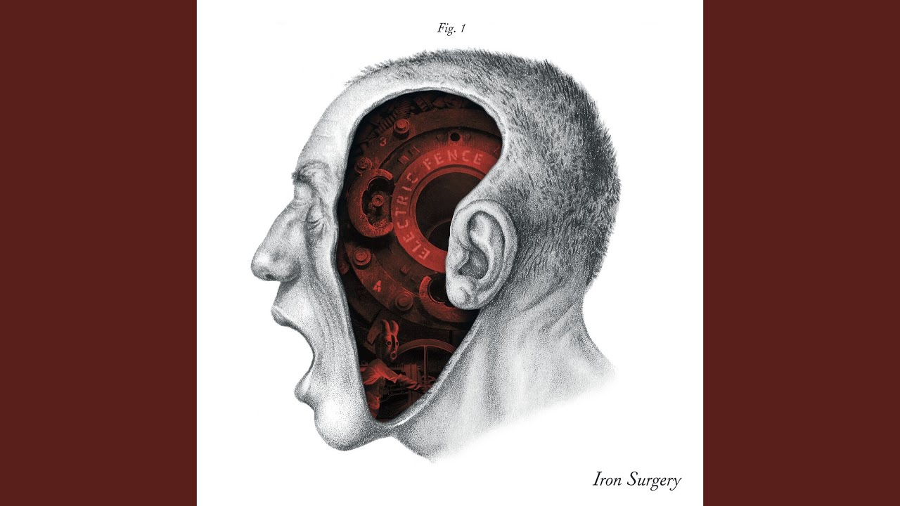Iron Surgery - YouTube
