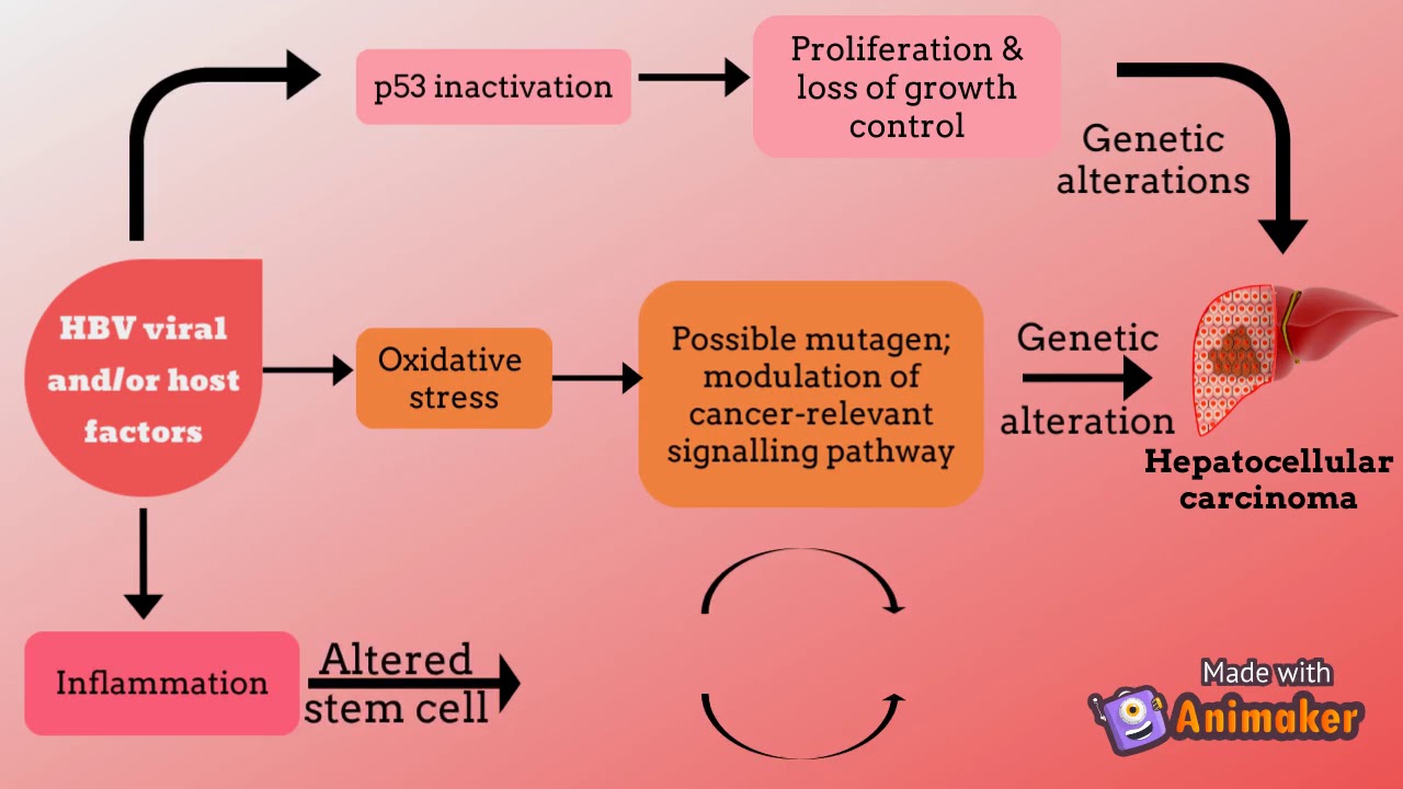 Molecular Pathogenesis of Liver Cancer - YouTube