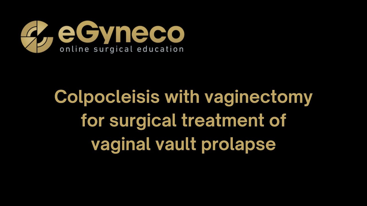 Colpocleisis and vaginectomy associated - YouTube