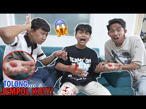 Waduh! Jari Jempol Bocil Tak Sengaja Kepot0ng Tang?? | Mikael Family