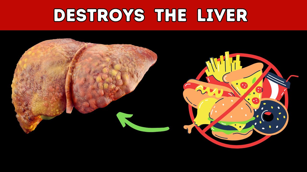 The Top 10 Foods That Destroy Your Liver: Beware of Your Body's Main ...