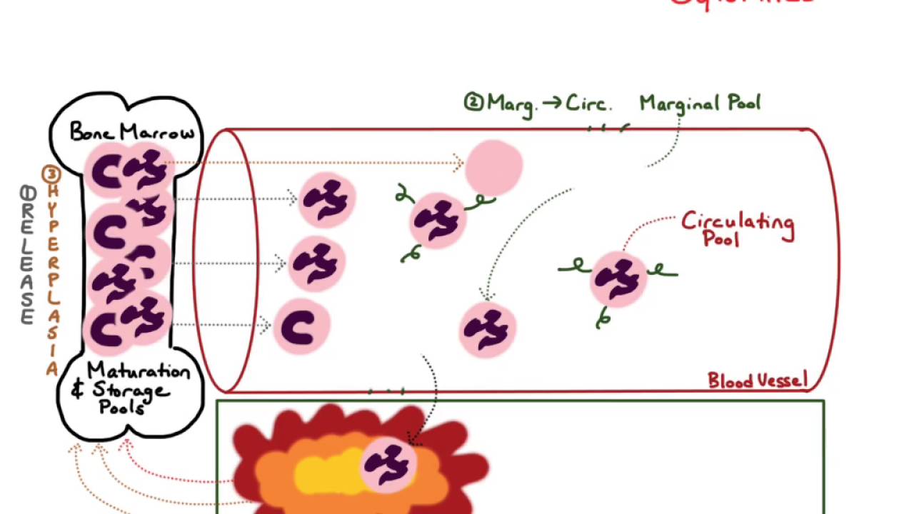 Inflammatory Neutrophilia - YouTube