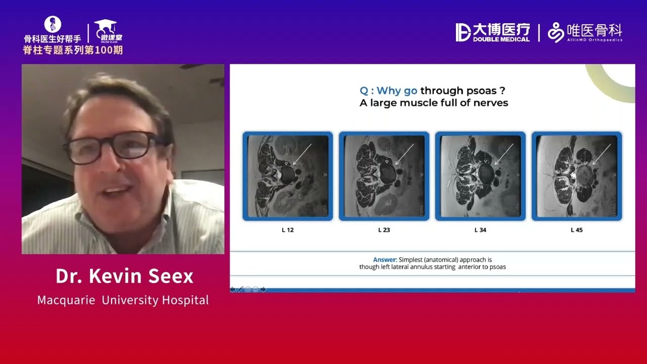 Spine Webinar: History and evolution of ATP surgery - Dr. Kevin Seex ...