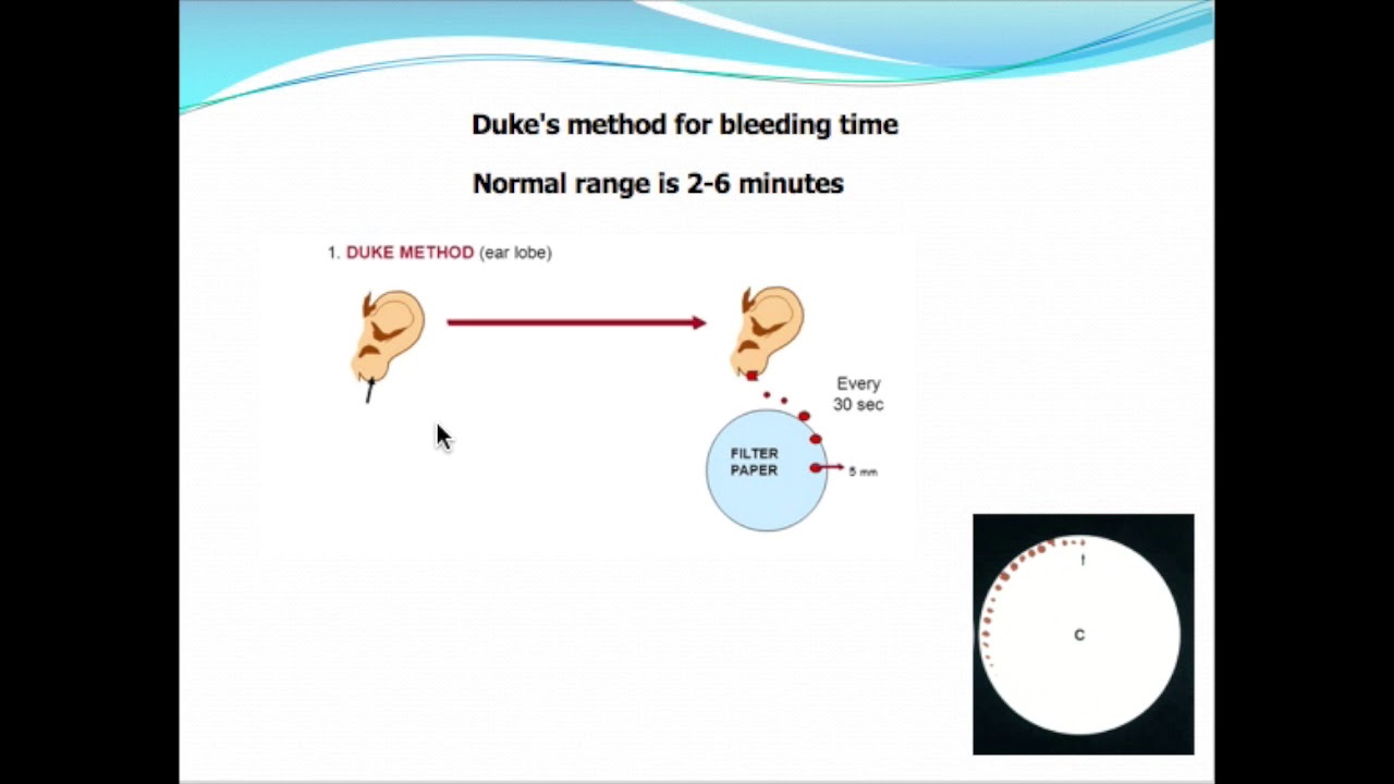 bleeding time - YouTube