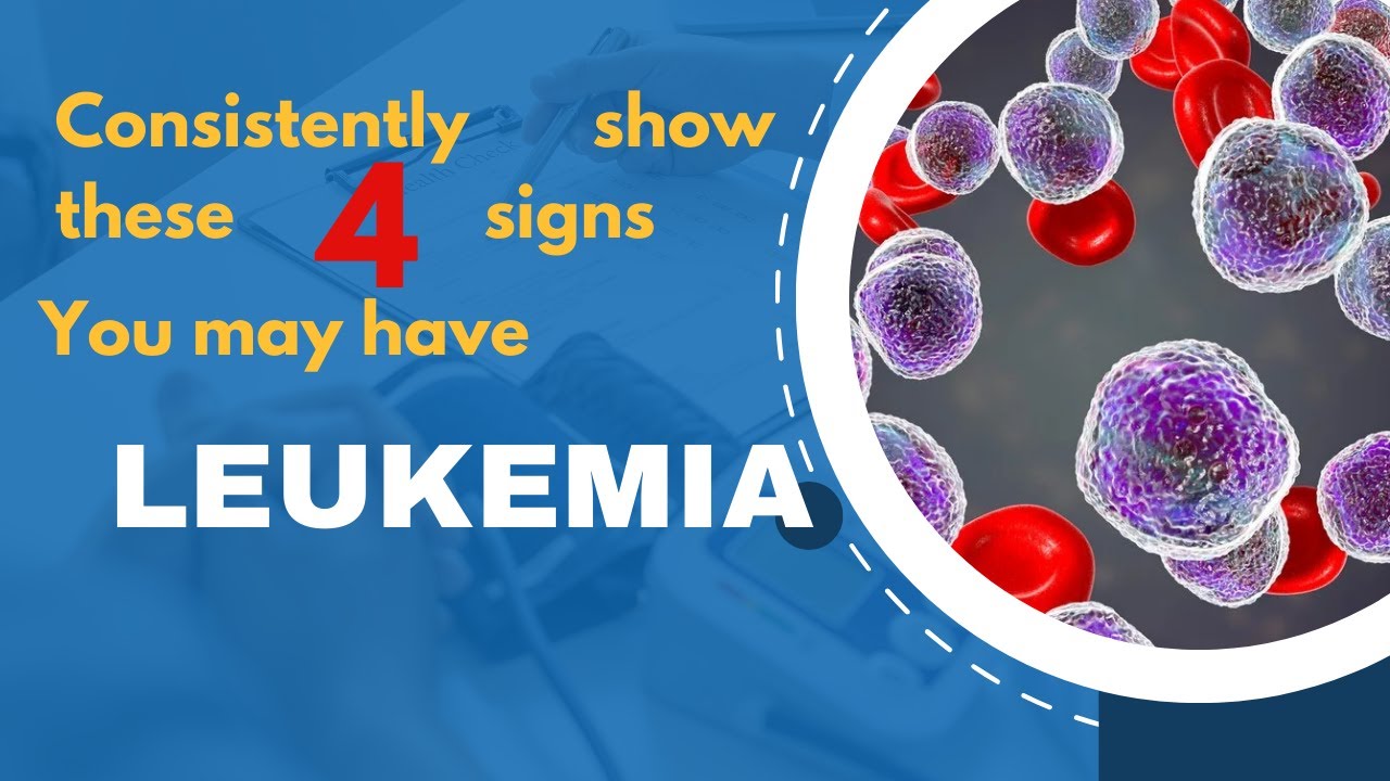 Understanding Leukaemia: Recognizing Symptoms and Preventive Measures ...
