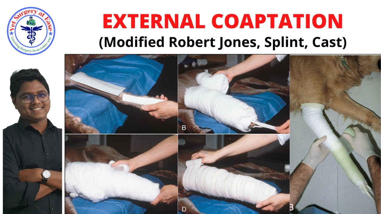 External Coaptation | Lecture 06 | Orthopedics - YouTube