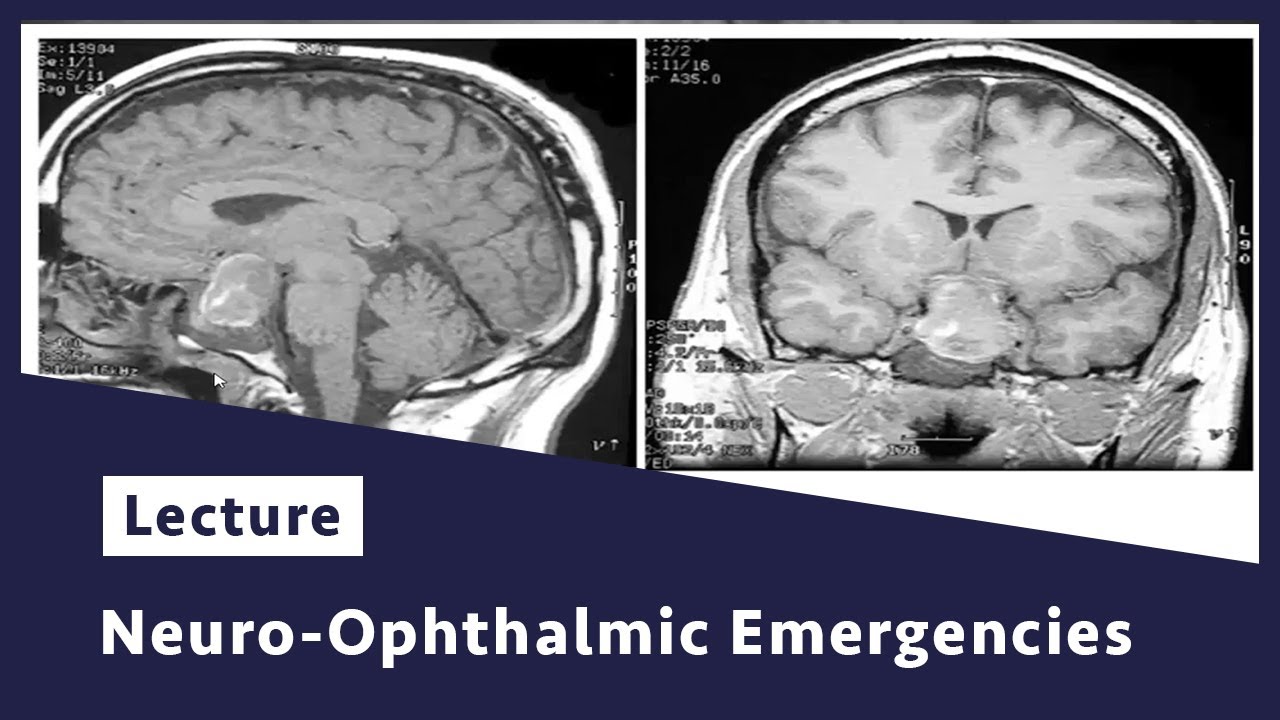 Neuro-ophthalmic Emergencies - YouTube