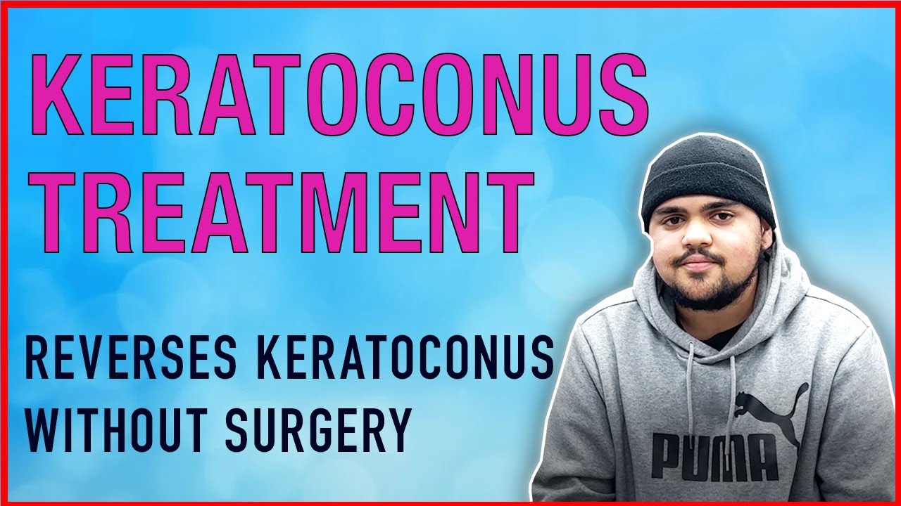 Keratoconus and Myopia -Vision Restored – Netra Restoration Therapy ...