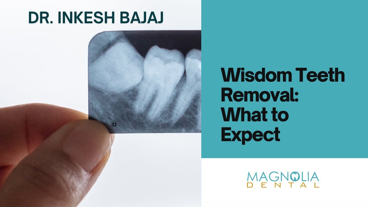 Unlocking the Mystery of Wisdom Teeth: Your Ultimate Guide with Dr. Inkesh Bajaj 👨‍⚕️ - YouTube