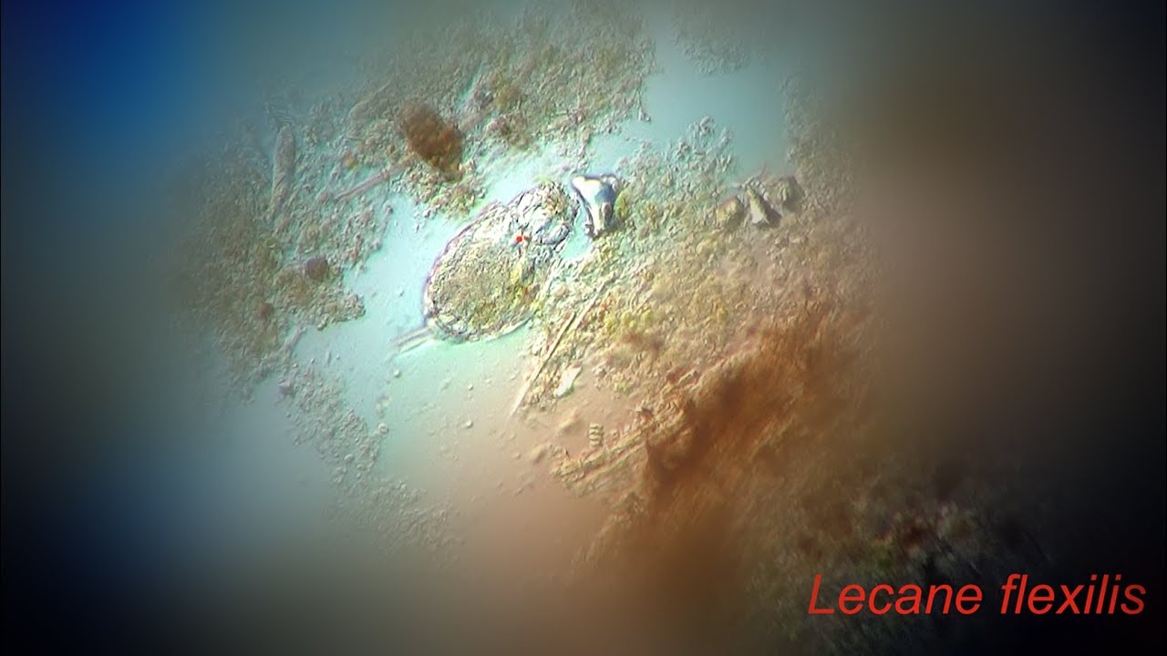 LECANE FLEXILIS - YouTube