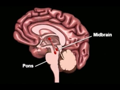 Sleep and Dreaming || Brain Anatomy, Anatomy of the Human Brain - YouTube