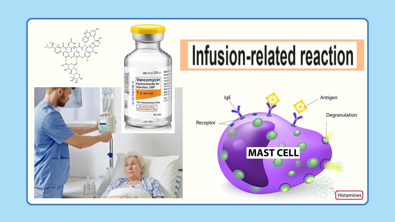 infusion related reaction - YouTube