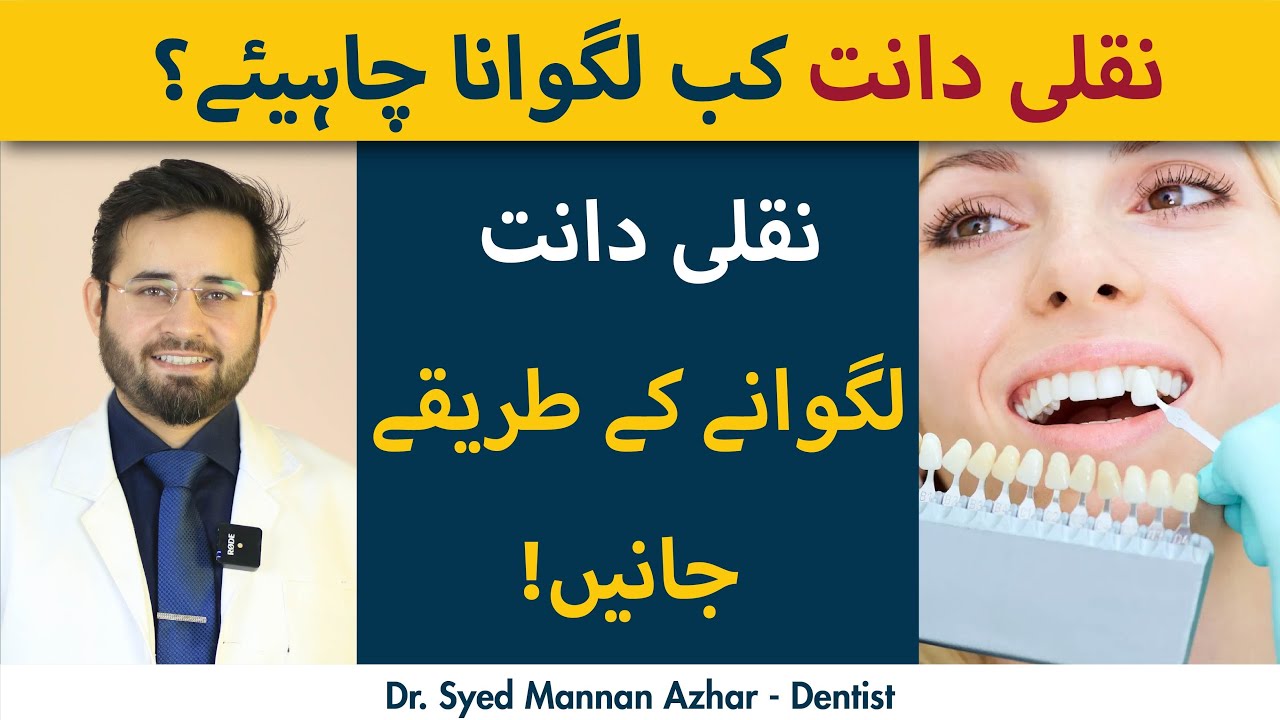 Nakli Daant Lagwany K Kon Kon Sy Treeky Hein? (Urdu/Hindi) | What Are ...