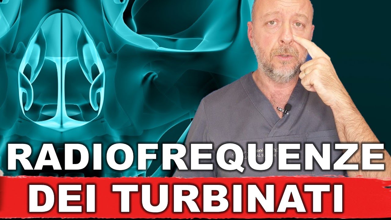 Radiofrequenza turbinati - YouTube