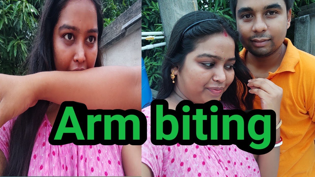 Arm biting#viral #vlog duet#arm biting video#funny video - YouTube
