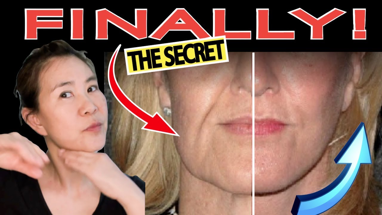 🤫 The Secret to Making Smile Lines Disappear 🥳 — No Surgery ️ - YouTube