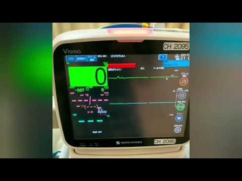 心電図モニター 実際の測定 Asystole(心静止) [NIHONKOHDEN Vismo PVM-4000] - YouTube