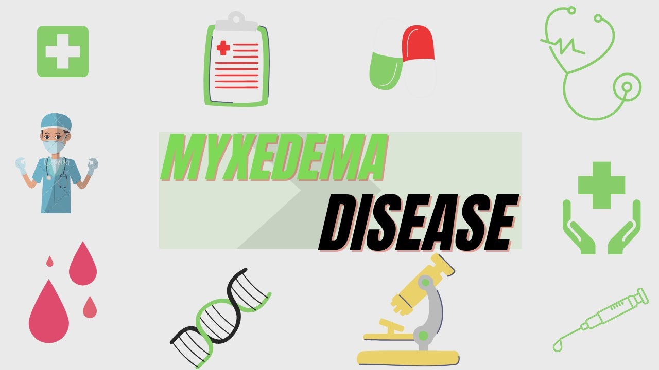 Myxedema: Definition, Symptoms, Diagnosis, Treatment - YouTube