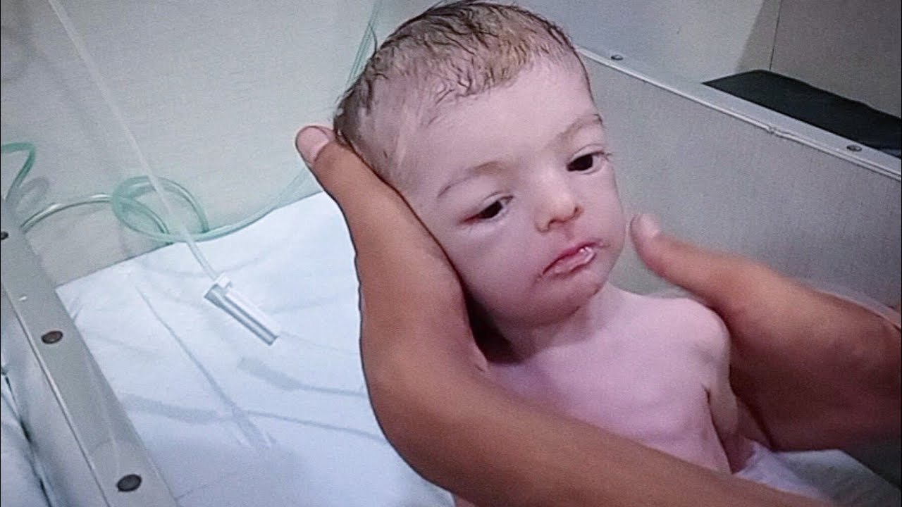 🍼 New Update in Abubakar Baby | Improvement Seen Thanks to Prayers@ll ...