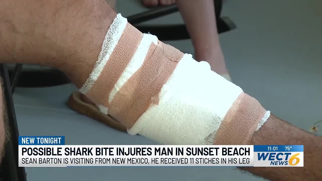 Swimmer receives 11 stitches after potential shark bite in Sunset Beach ...
