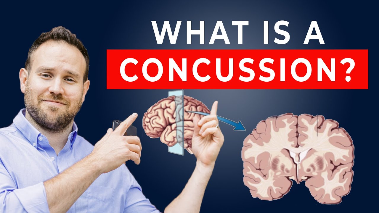 What is a Concussion? | Concussion Patient Education Series | Ep. 1 ...