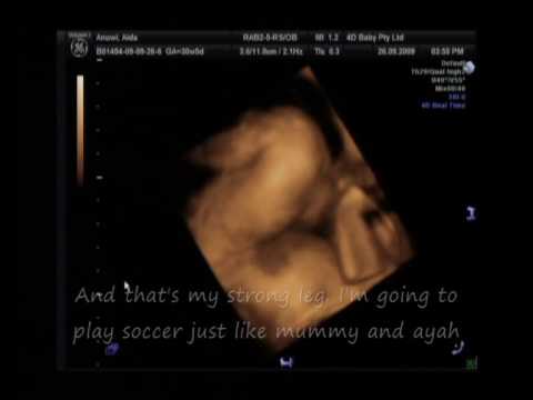Aida's and Ariff's baby 3d/4d Ultrasound