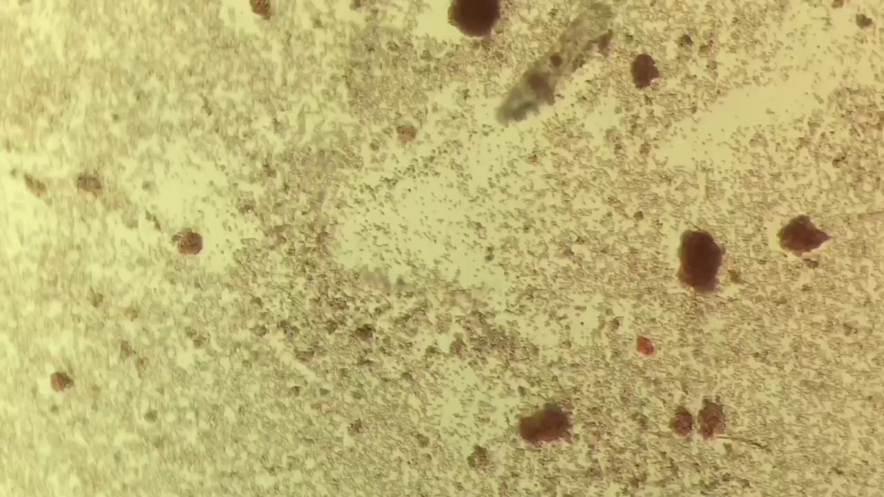 Intercellular movement of Paramecium - YouTube